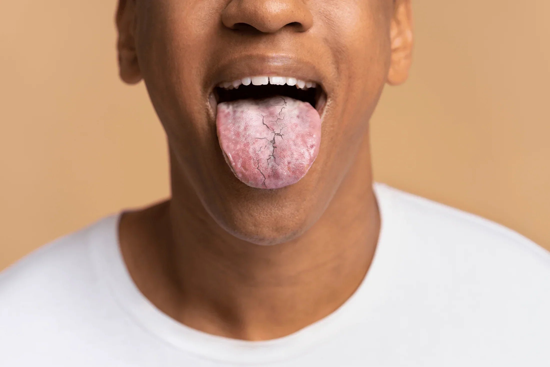 Mouth Tape for Snoring: Complete Guide to Better Sleep | Solid8 ...